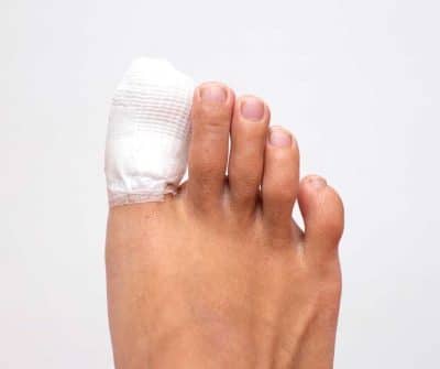 Toenail Removal: Everything You Need To Know