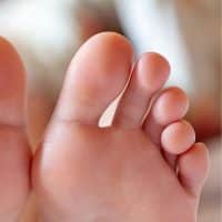 What To Expect After Nail Removal Surgery